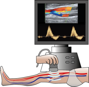 Dr Andrzejewski - Echo doppler